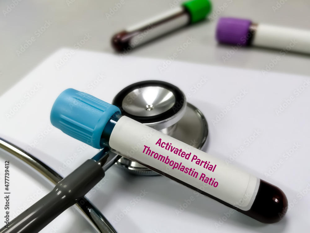 Blood sample tube for Activated Partial Thromboplastin Time Ratio (APTR ...