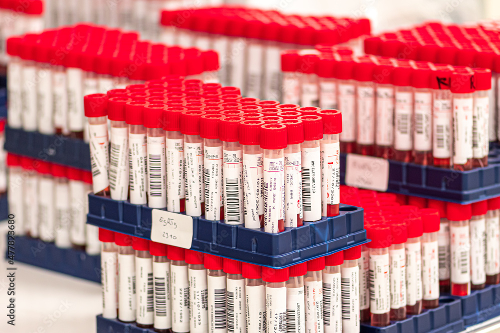Real series of molecular PCR tests, nasal and oropharyngeal swabs with ...