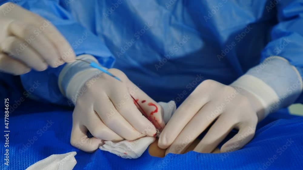 Vascular surgery in modern clinic. Professional doctors in surgical ...