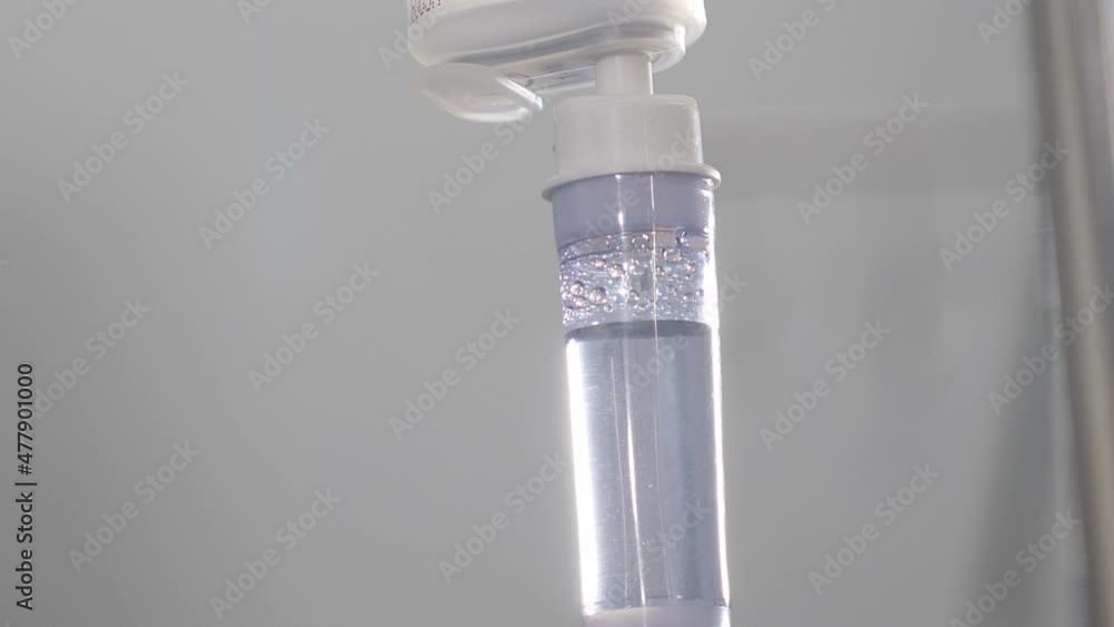 Infusion dripping. Medical IV Drop Rate. medical dropper close up. Drop ...