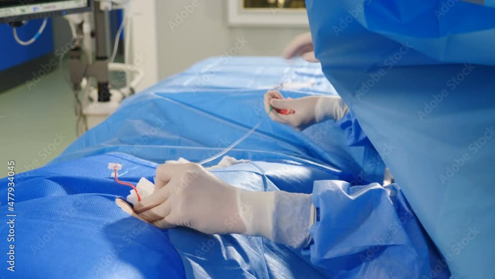 Vascular surgery. Hands of radiologist performing endovascular ...