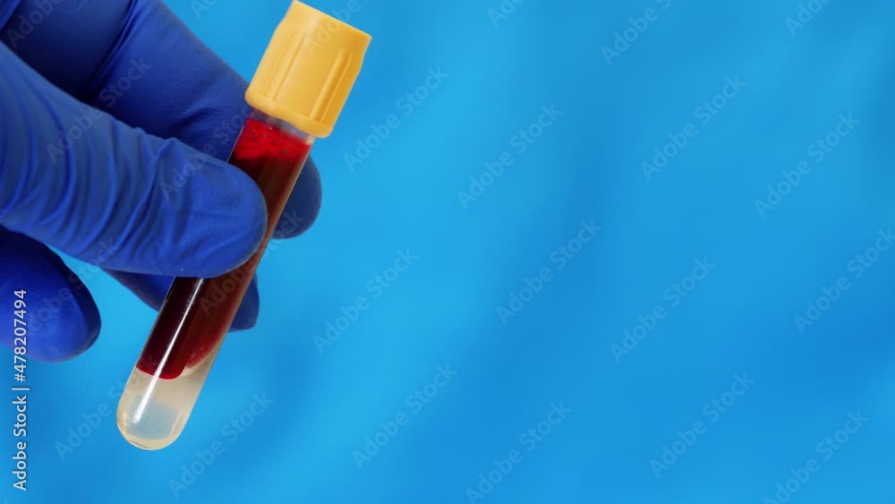 Container of human blood. Hand in blue nitrile glove holds test tube ...