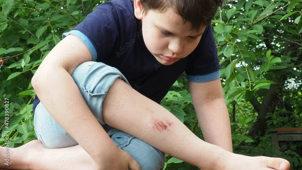 Closeup of injured young kid's knee after he fell down on pavement. the ...