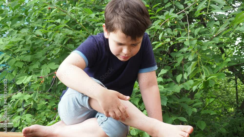 Closeup of injured young kid's knee after he fell down on pavement. the ...