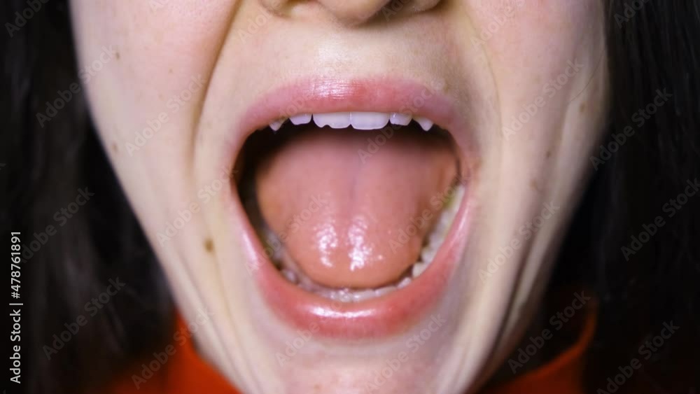A woman with malocclusion and dysfunction of the temporomandibular ...