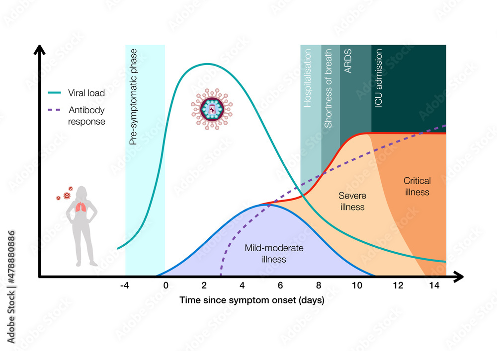 Infographic illustration of COVID-19 illness progression Stock ...