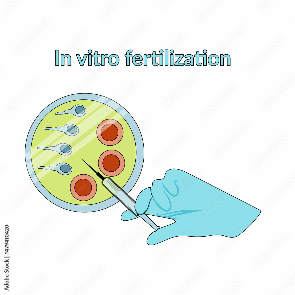 In vitro fertilization. Detailed infographic showing laboratory ... In vitro fertilization. Detailed infographic showing laboratory ...