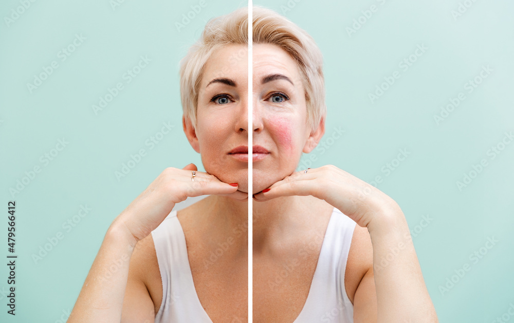 Professional cosmetology. Portrait of a adult caucasian woman with ...