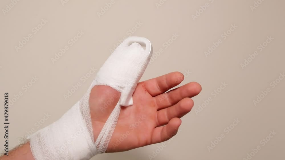 White bandages and a splint on the arm.Broken arm.Bandage and splint on ...