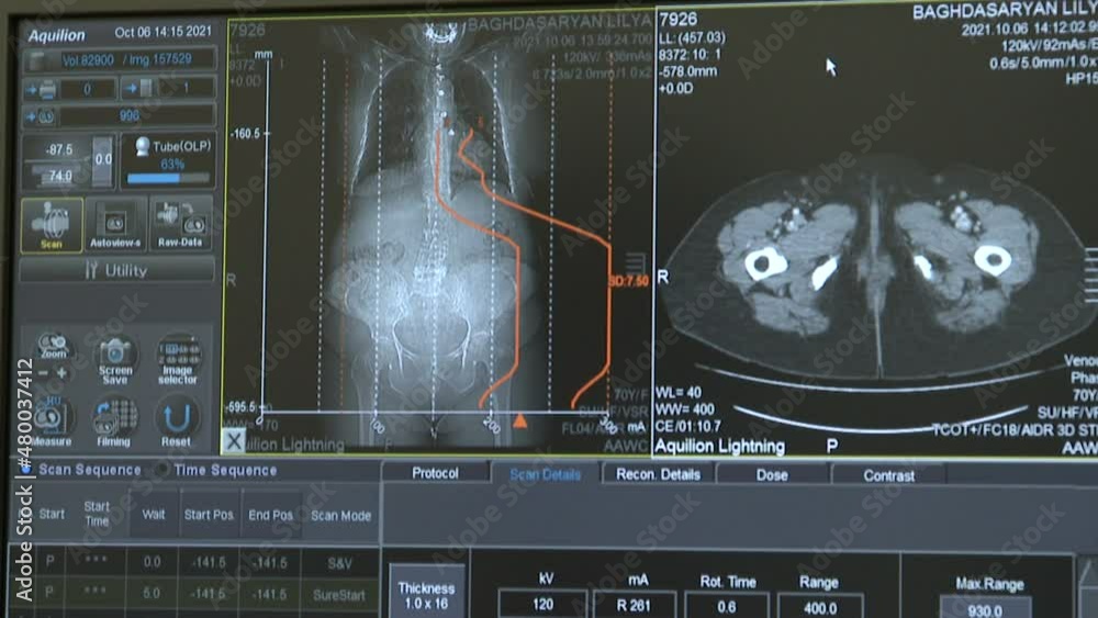 MRI scan screen animation. Computed medical tomography MRI. Diagnosis ...