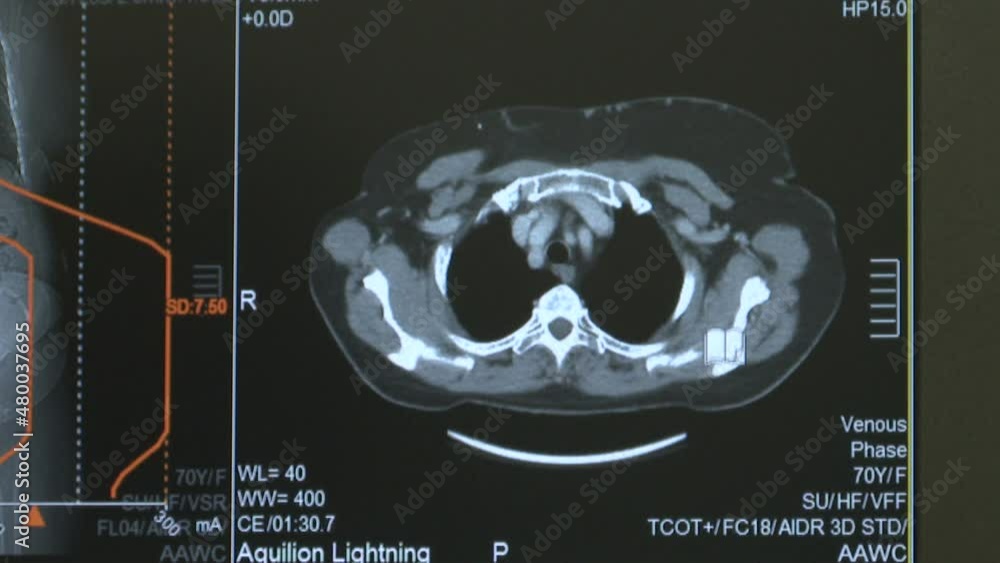 MRI scan screen animation. Computed medical tomography MRI. Diagnosis ...