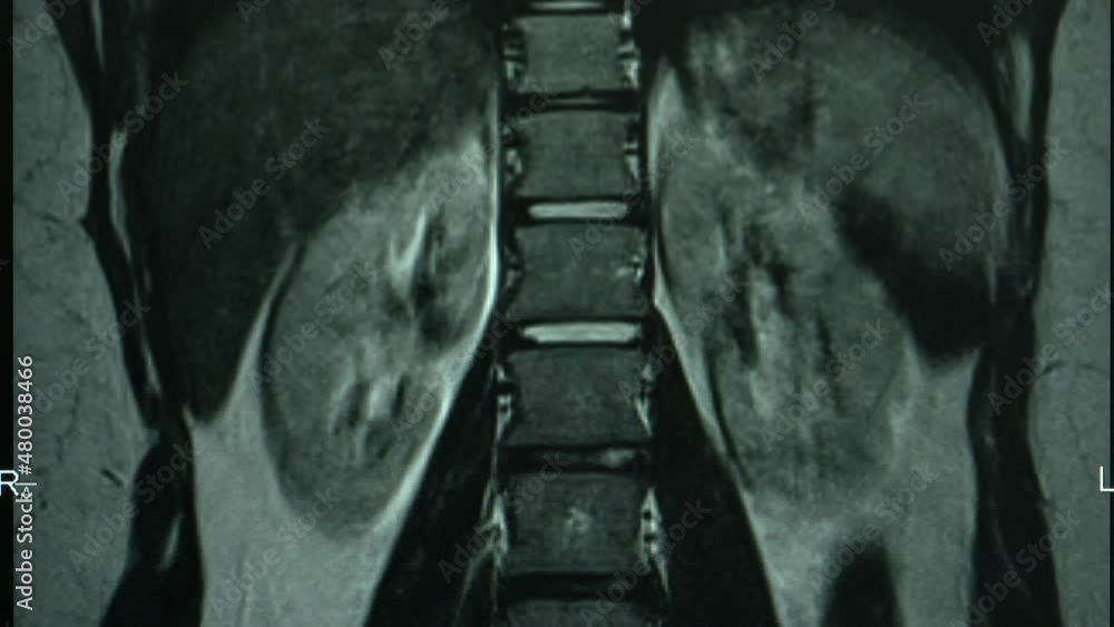 MRI scan screen animation. Computed medical tomography MRI. Diagnosis ...