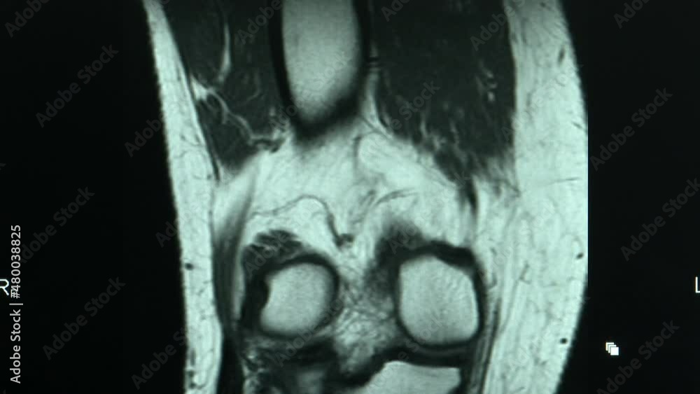MRI scan screen animation. Computed medical tomography MRI. Diagnosis ...