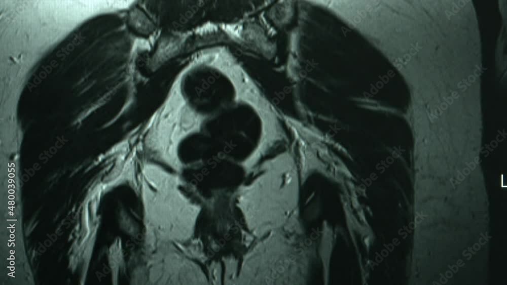 MRI scan screen animation. Computed medical tomography MRI. Diagnosis ...