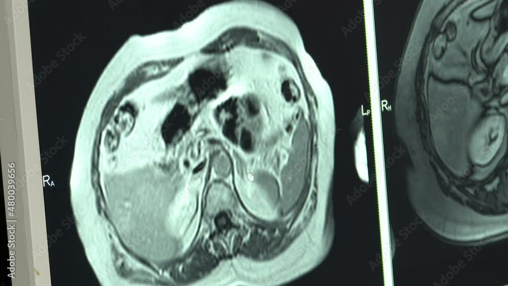 MRI scan screen animation. Computed medical tomography MRI. Diagnosis ...