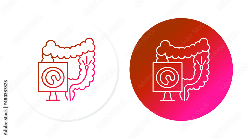 Proctoscopy Vs Colonoscopy