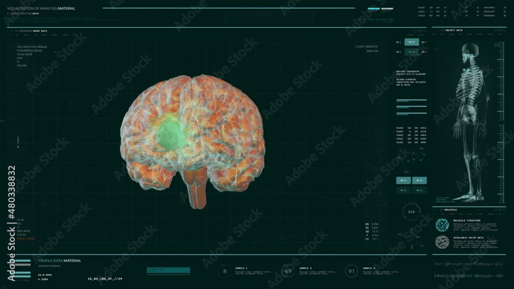 Medical scan system is inspecting the structure of the brain. Medical ...
