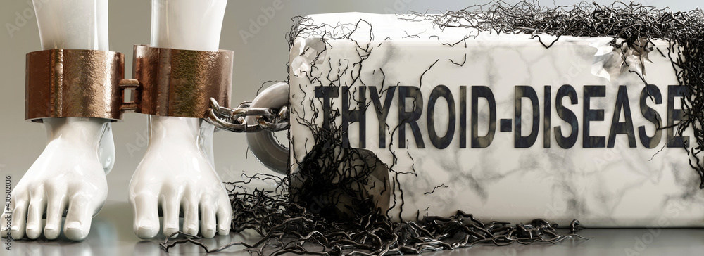 Thyroid disease that entraps, limits life, enslaves and brings ...
