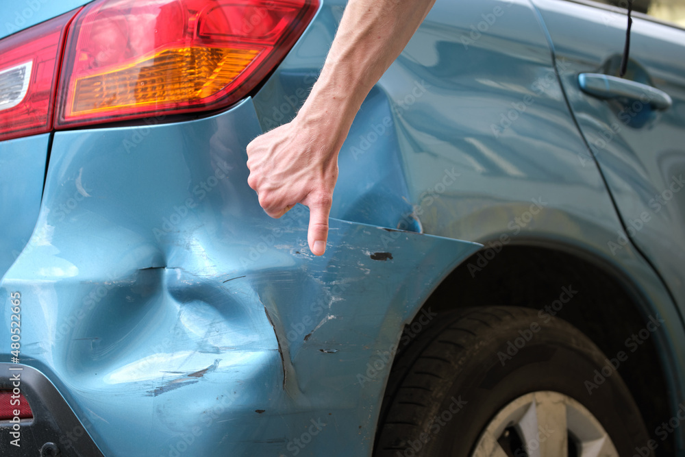 Foto de Driver hand examining dented car with damaged fender parked on ...