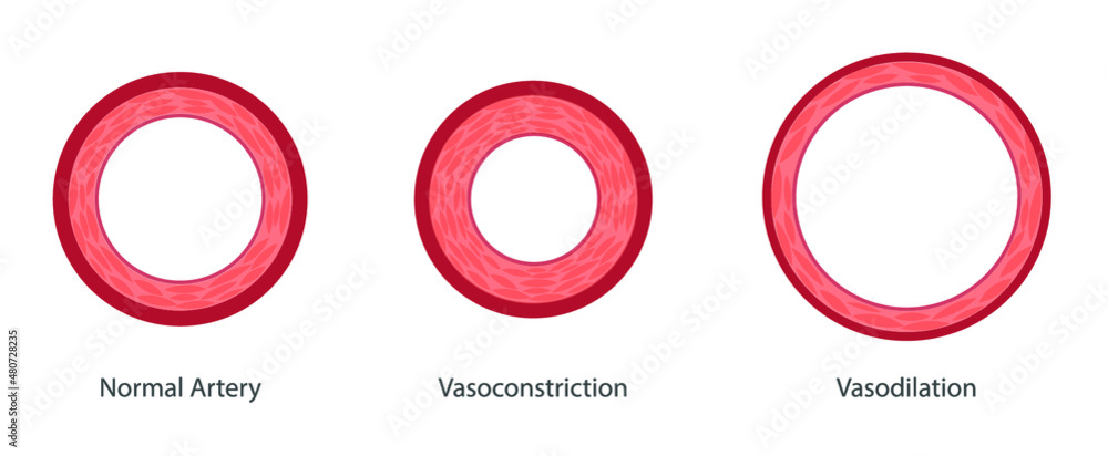 Vasodilation and Vasoconstriction ilustration. Different thickness of a ...