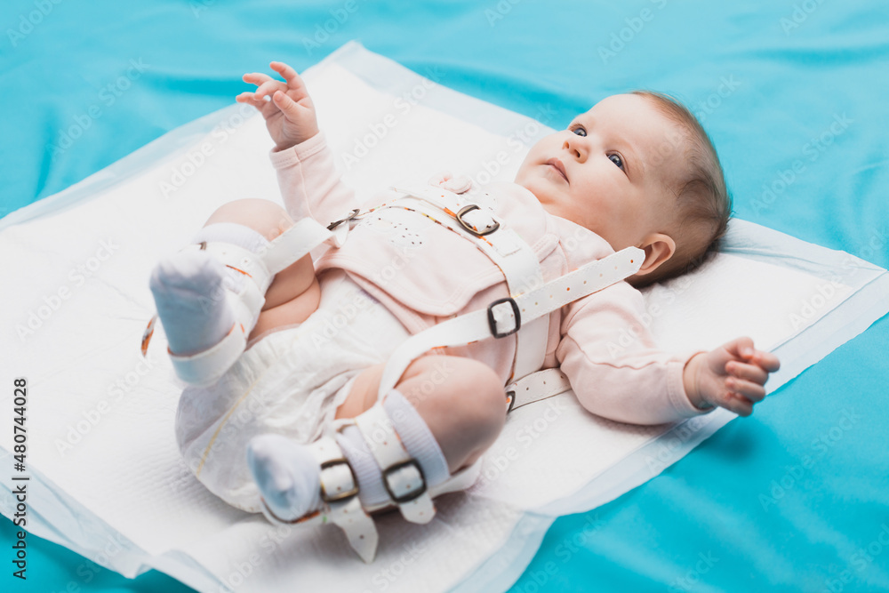 A baby wearing a harness that corrects hip dysplasia Stock Photo ...