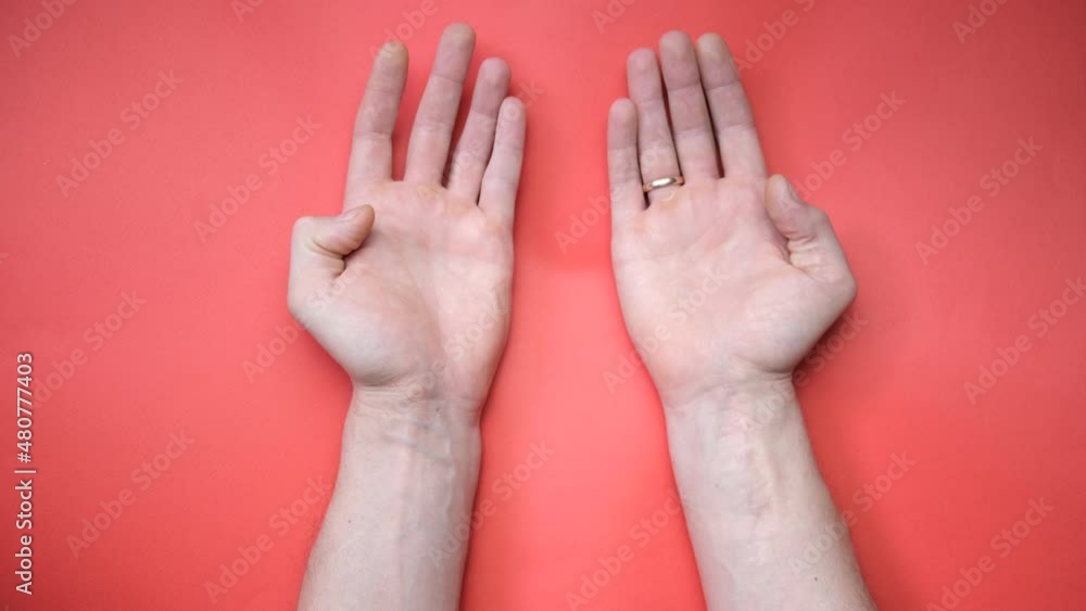 a scar on the wrist from tendon and nerve surgery, a cut on the hand ...