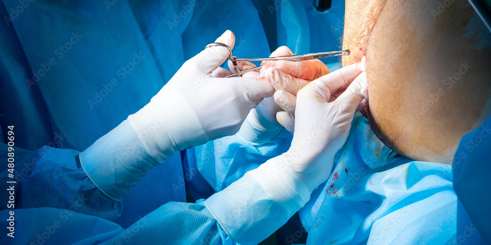 Hands of surgeons in sterile gloves with surgical instruments during ...