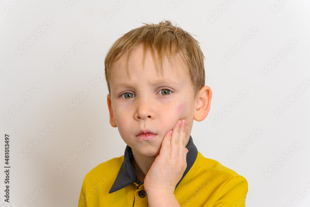 A hematoma on the face under the boy's left eye. Injury in a fall. The ...