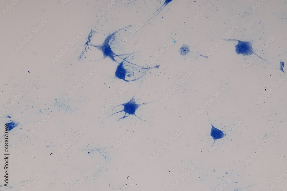 Motor Neuron and nerve cells under the microscope in Lab. Stock Photo ...