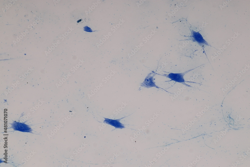 Motor Neuron and nerve cells under the microscope in Lab. Stock Photo ...