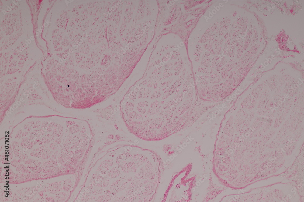 Motor Neuron and nerve cells under the microscope in Lab. Stock Photo ...