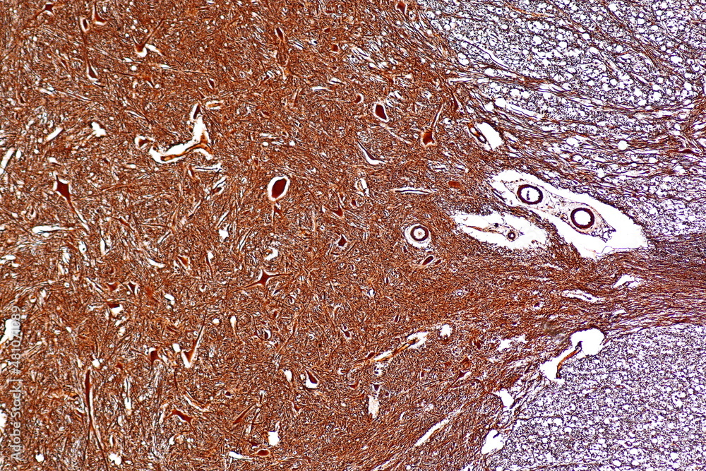 Motor Neuron and nerve cells under the microscope in Lab. Stock Photo ...