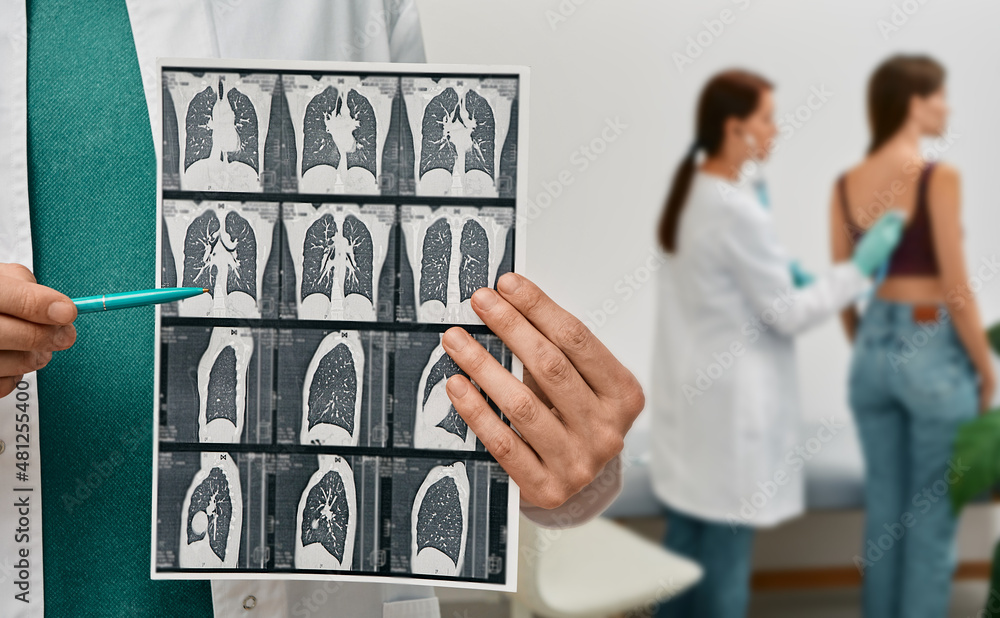 Pulmonologist showing CT scan of lungs female with pneumonia over ...