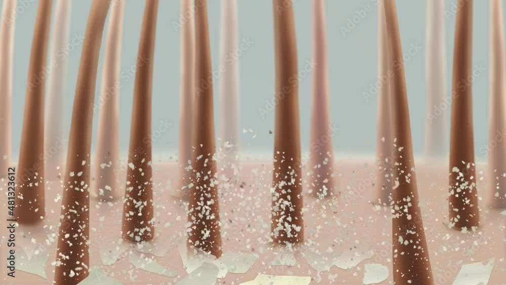 Scalp treatment. Dandruff on hair. Close-up. The medicine gets on the ...