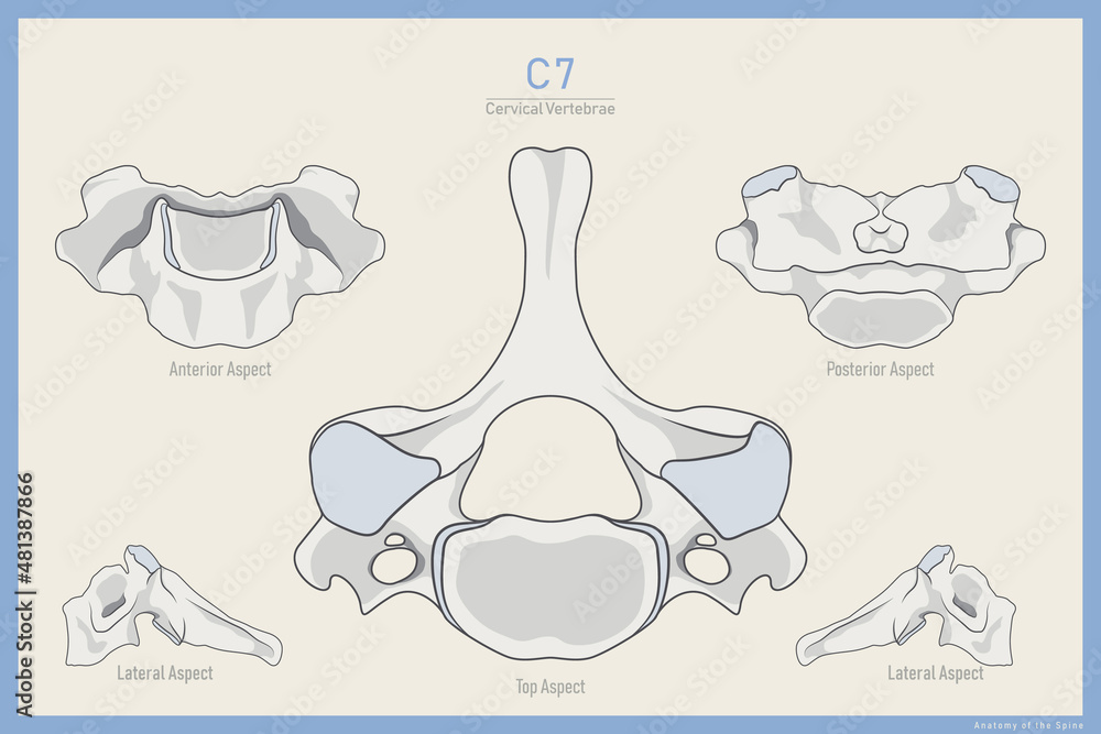 Anatomy of the 7th Cervical Vertebra. Vertebra Prominens C7. Anterior ...