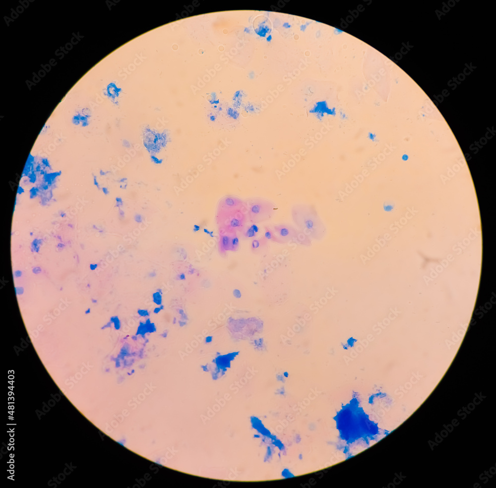 Microphotograph Of Squamous Epithelial Cell In Gram Stain To Identify Gram Positive And Gram
