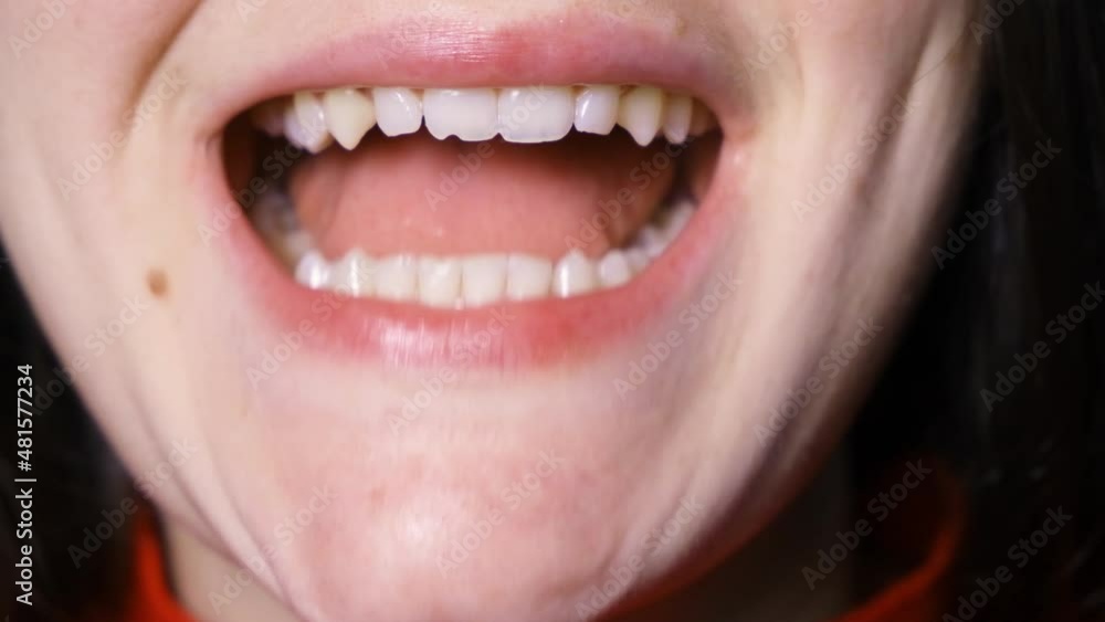 A patient with temporomandibular joint dysfunction shows malocclusion ...