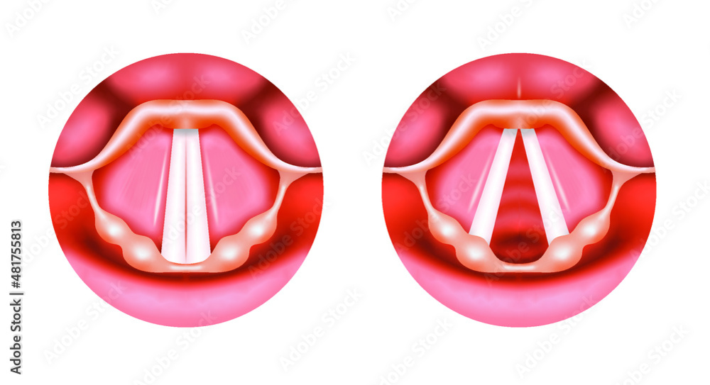 Vocal cords Stock Vector | Adobe Stock