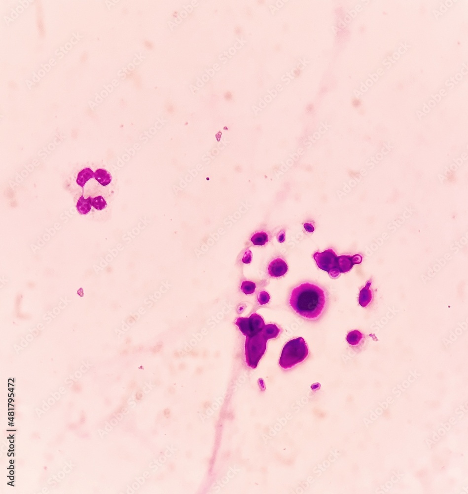 Encapsulated yeast in body fluid. Stock Photo | Adobe Stock