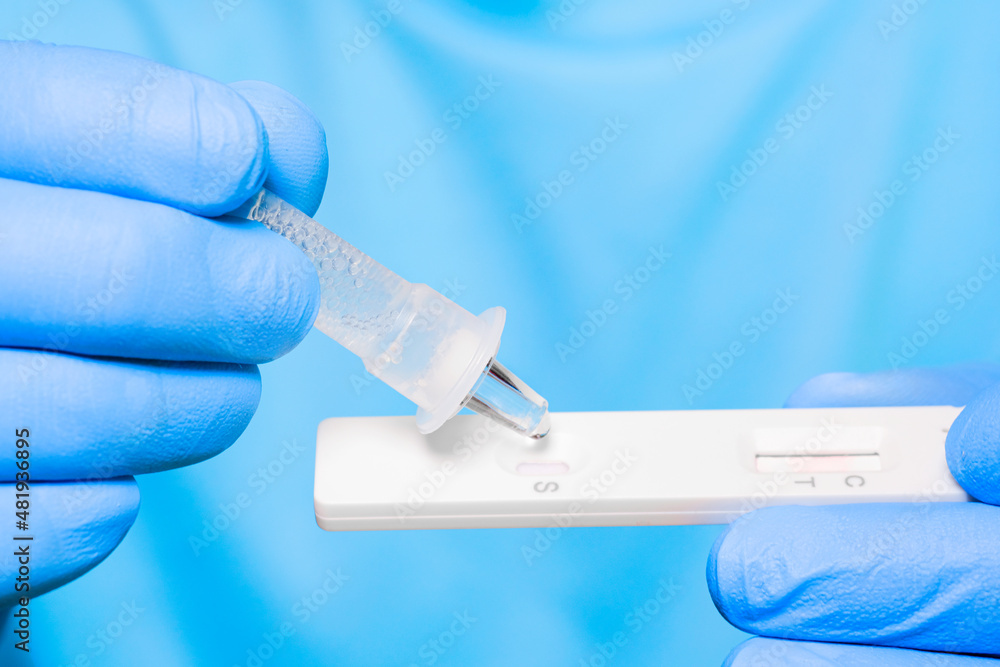 Hand of doctor drops reagent onto coronavirus (Covid 19) antigen test ...