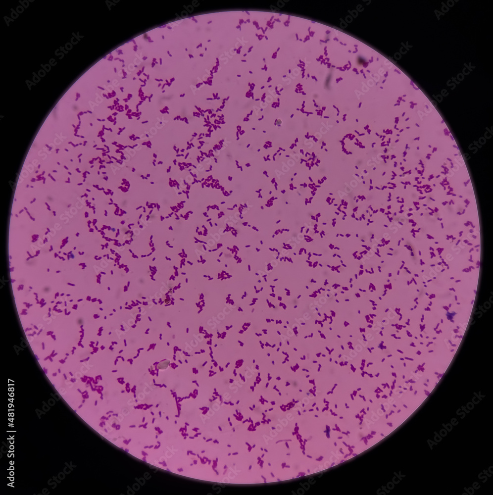 Escherichia coli bacterium, E.coli, gram-negative rod-shaped bacteria ...
