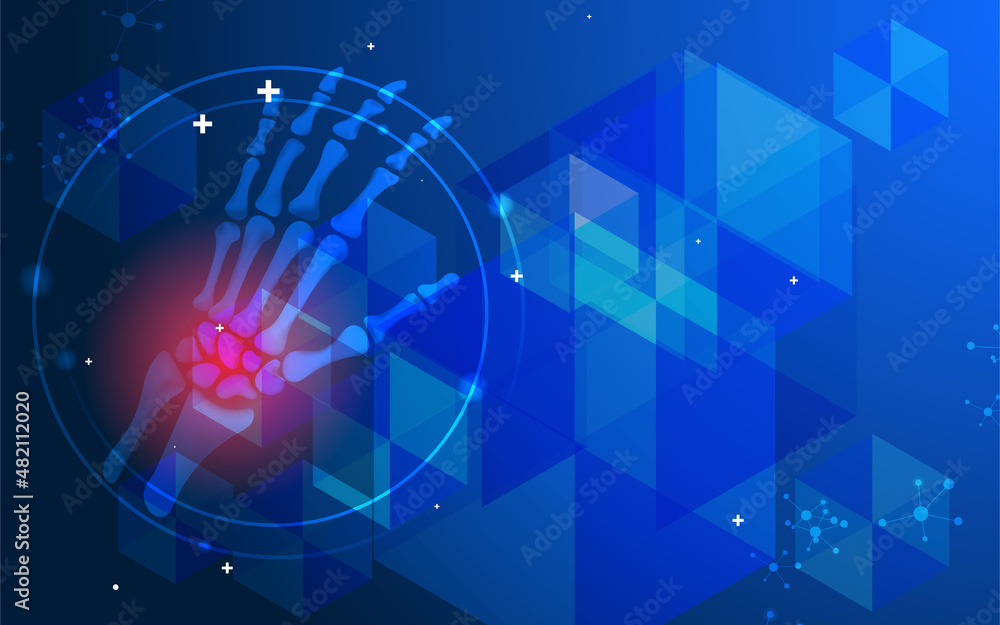 Abstract science medical orthopedics of wrist and hand injury. The ...