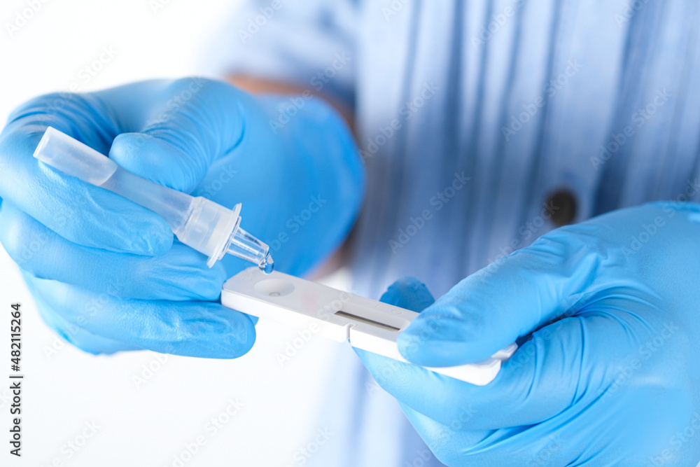 Hand of doctor drops reagent onto coronavirus (Covid 19) antigen test ...