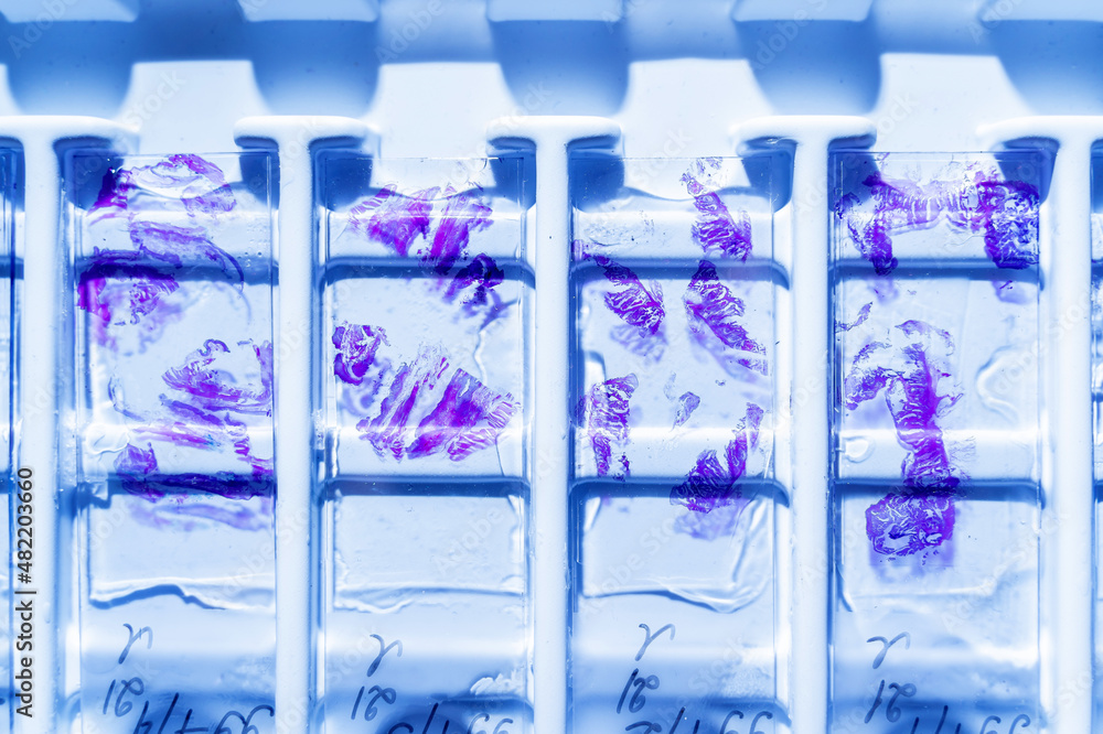 Rows of microscope glass slide in the cells Stock Photo | Adobe Stock