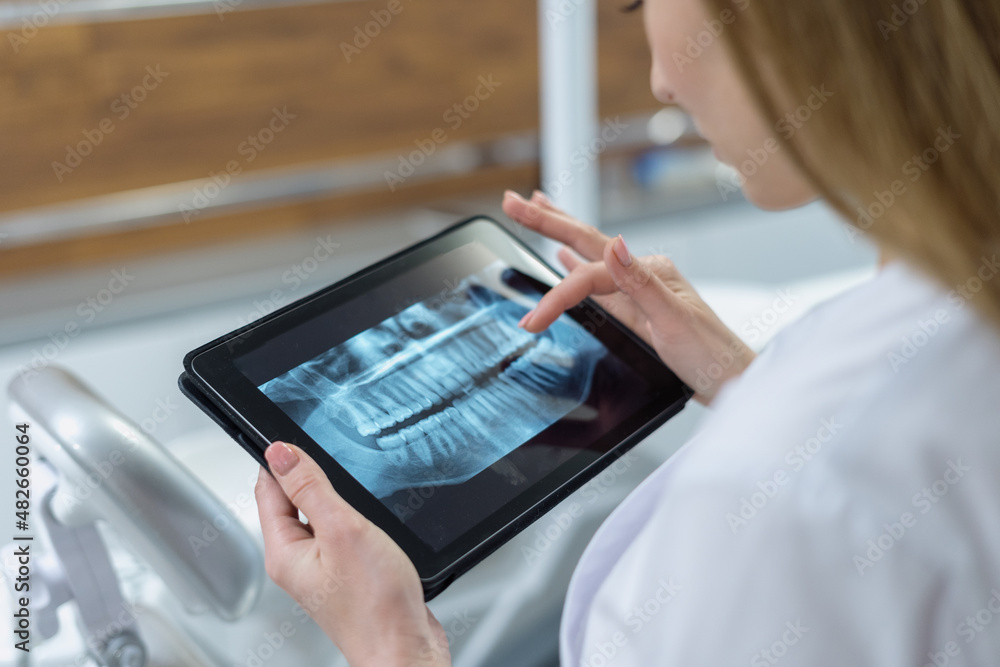 Dentist examines panoramic tooth x-ray image using tablet Stock Photo ...