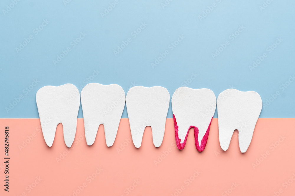 White teeth bleeding cartoon made from paper. Bleeding gums are a sign ...