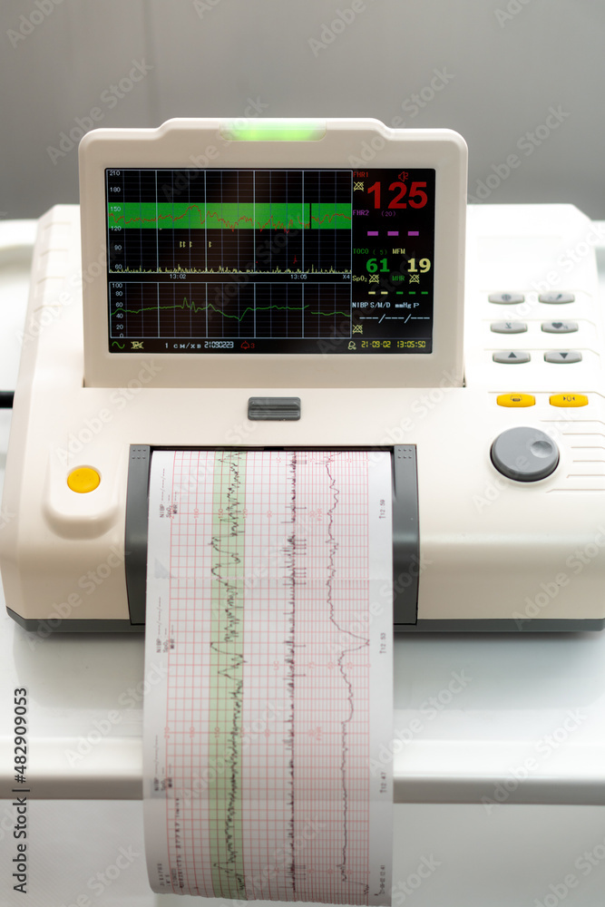 Electronic Cardiotocography Machine Monitoring Fetal Heart Contractions ...