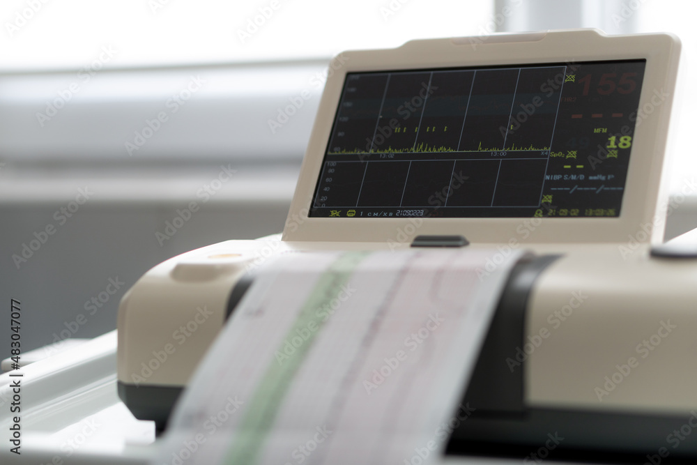 Electronic Cardiotocography Machine Monitoring Fetal Heart Contractions ...