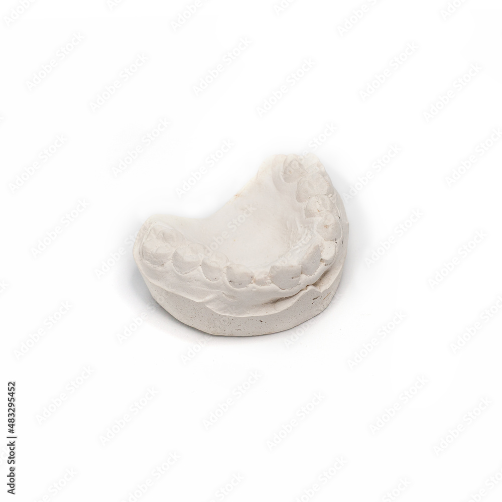 plaster cast of the upper jaw of a child isolated on white background ...
