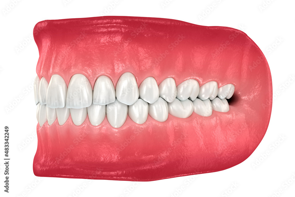 Healthy human teeth with normal occlusion. Medically accurate tooth 3D ...